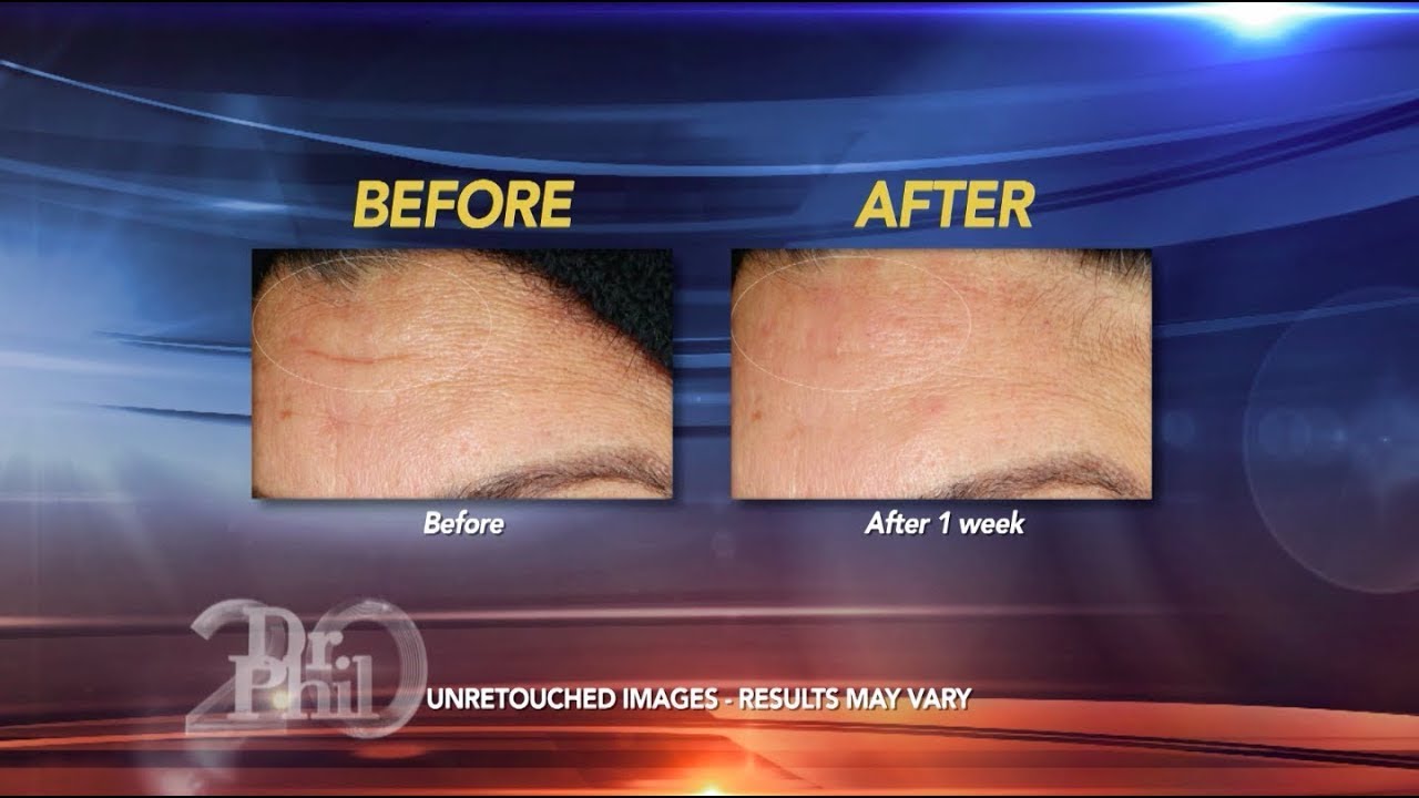 See Visibly Plumper Skin With Multi Correxion Hydrate Serum Capsules By ...