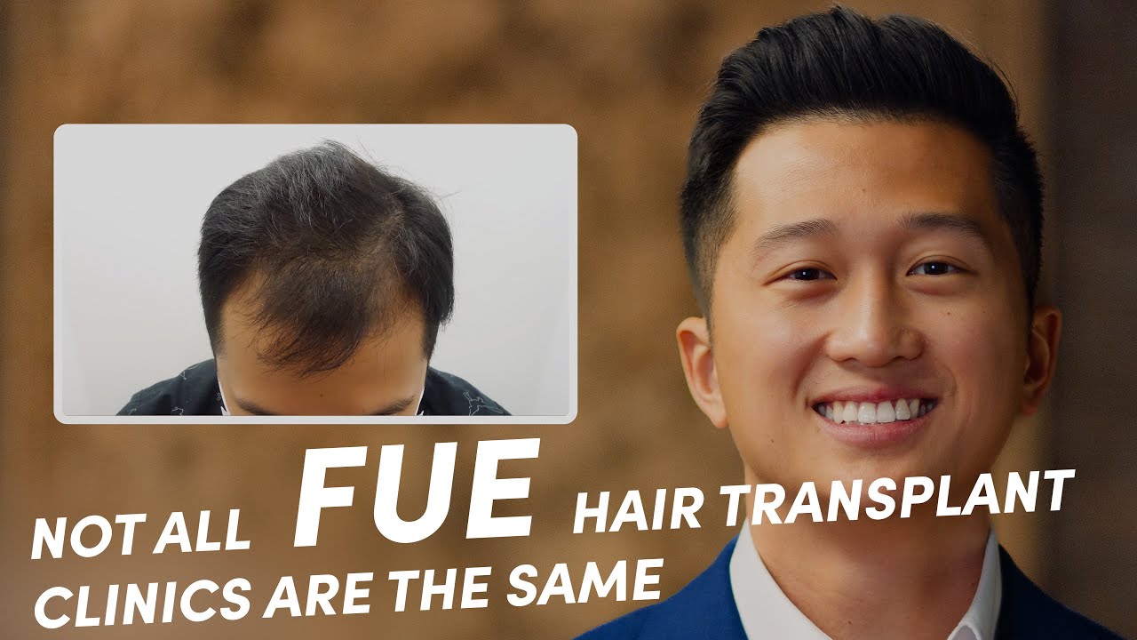 Advanced FUE™️ Hair Transplant | Advanced Hair - YouTube