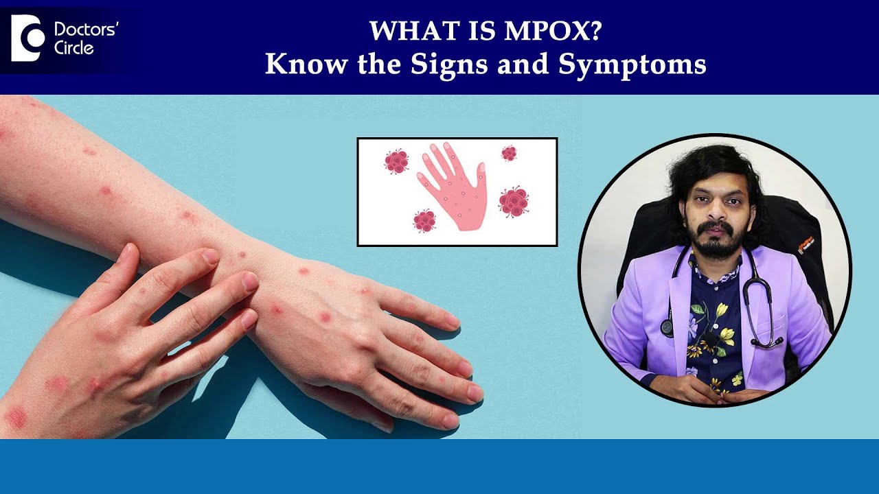 Monkeypox rash on skin | MPox Symptoms & Diagnosis| Mpox Phases-Dr ...