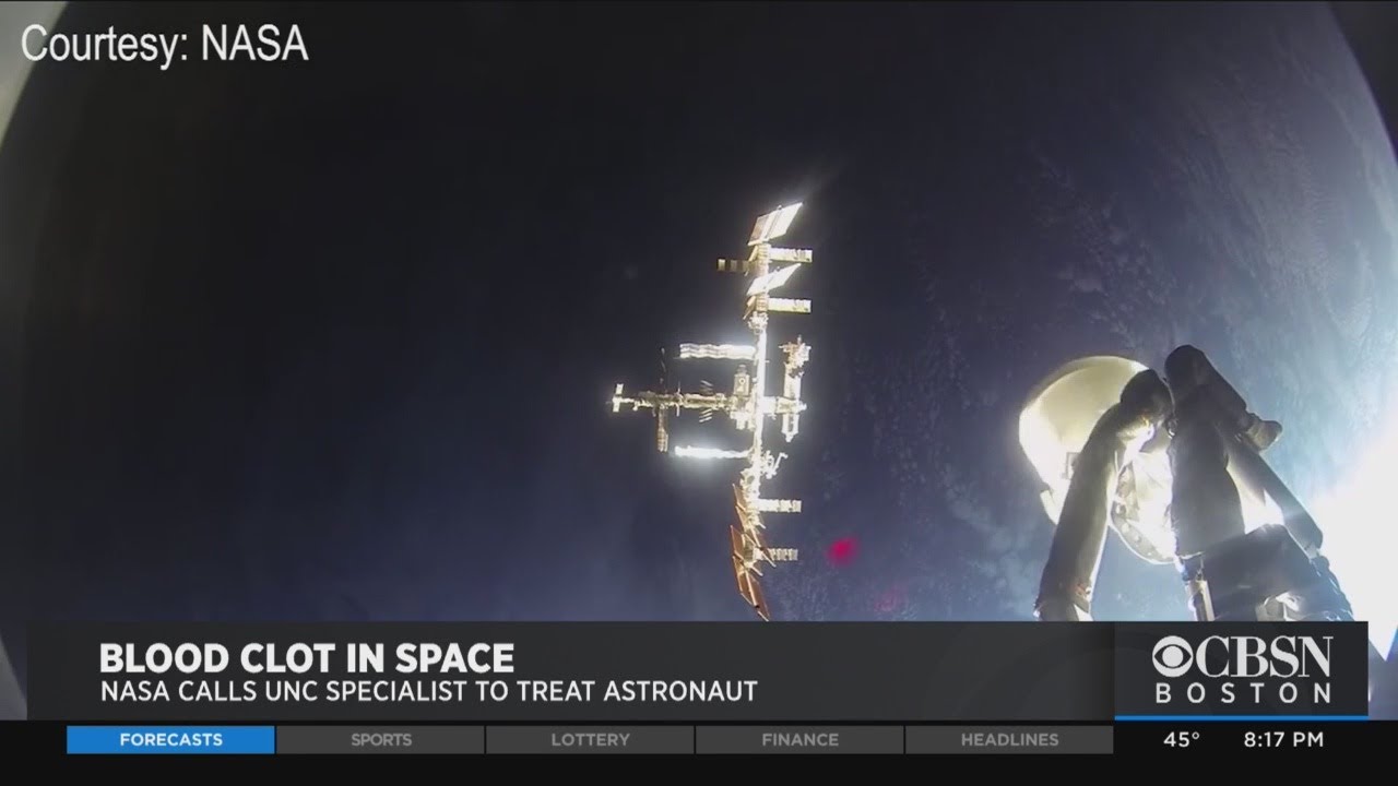 NASA Astronaut Had The First Known Blood Clot In Space - YouTube