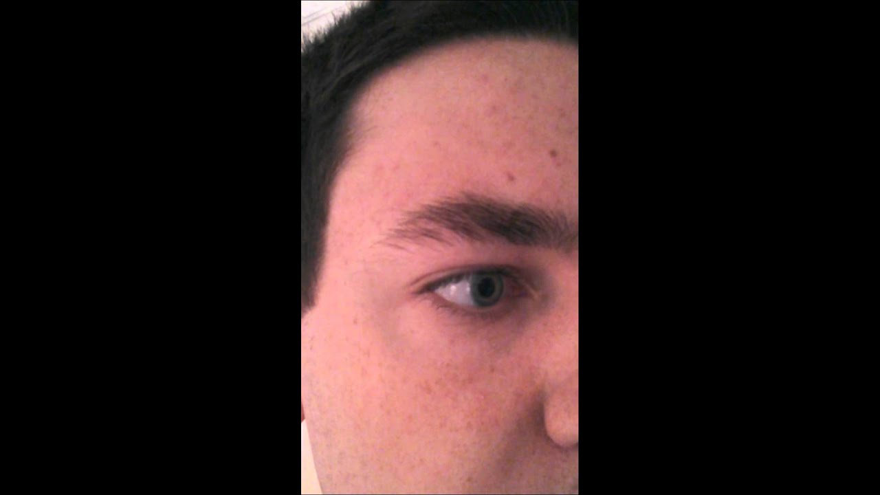 optokinetic-nystagmus-youtube