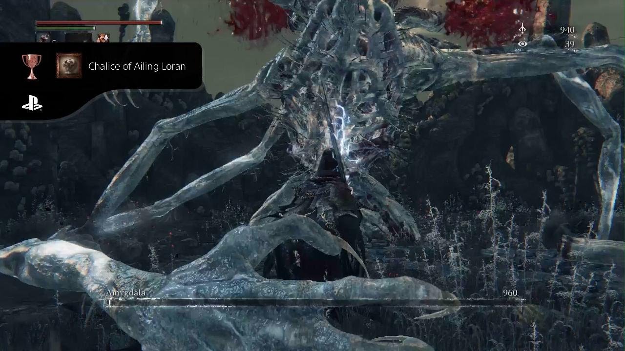 God ihate amygdala - YouTube
