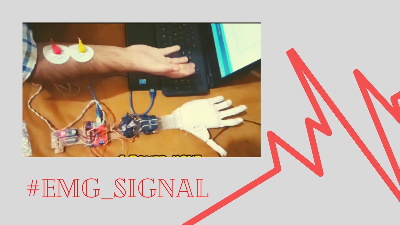 EMG Based Prosthetic Hand For Amputees | Liono Maker Official - YouTube