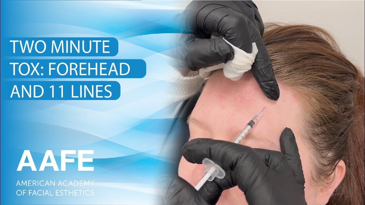 Two Minute Tox: Forehead and 11 Lines - YouTube