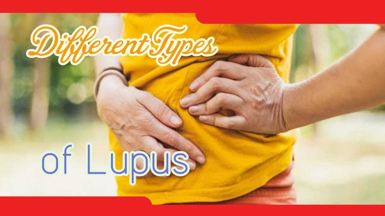 What are the Different Types of Lupus? - YouTube