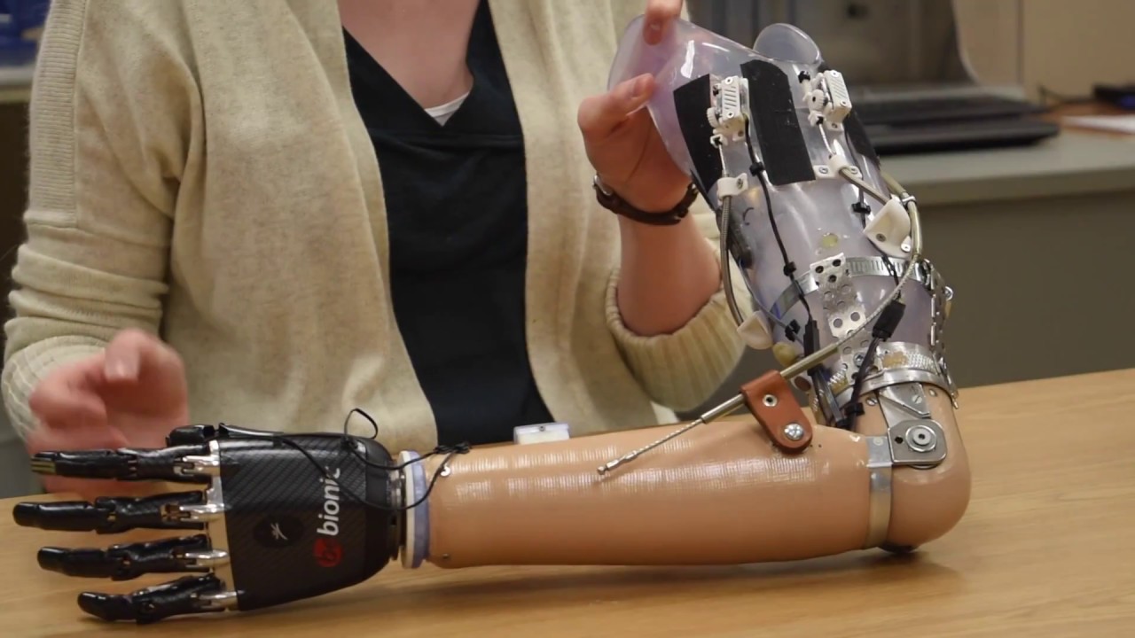 Using new technology to help amputees reconnect with the world - YouTube