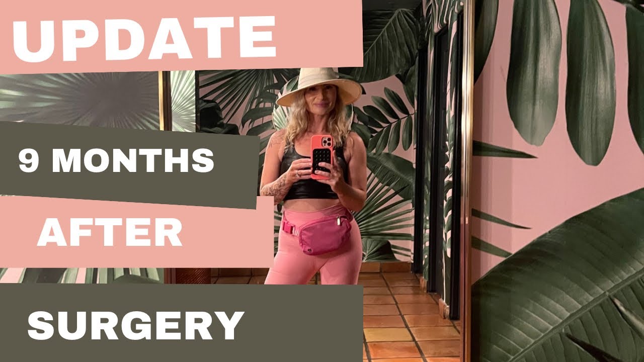 Update after WAL liposuction - YouTube