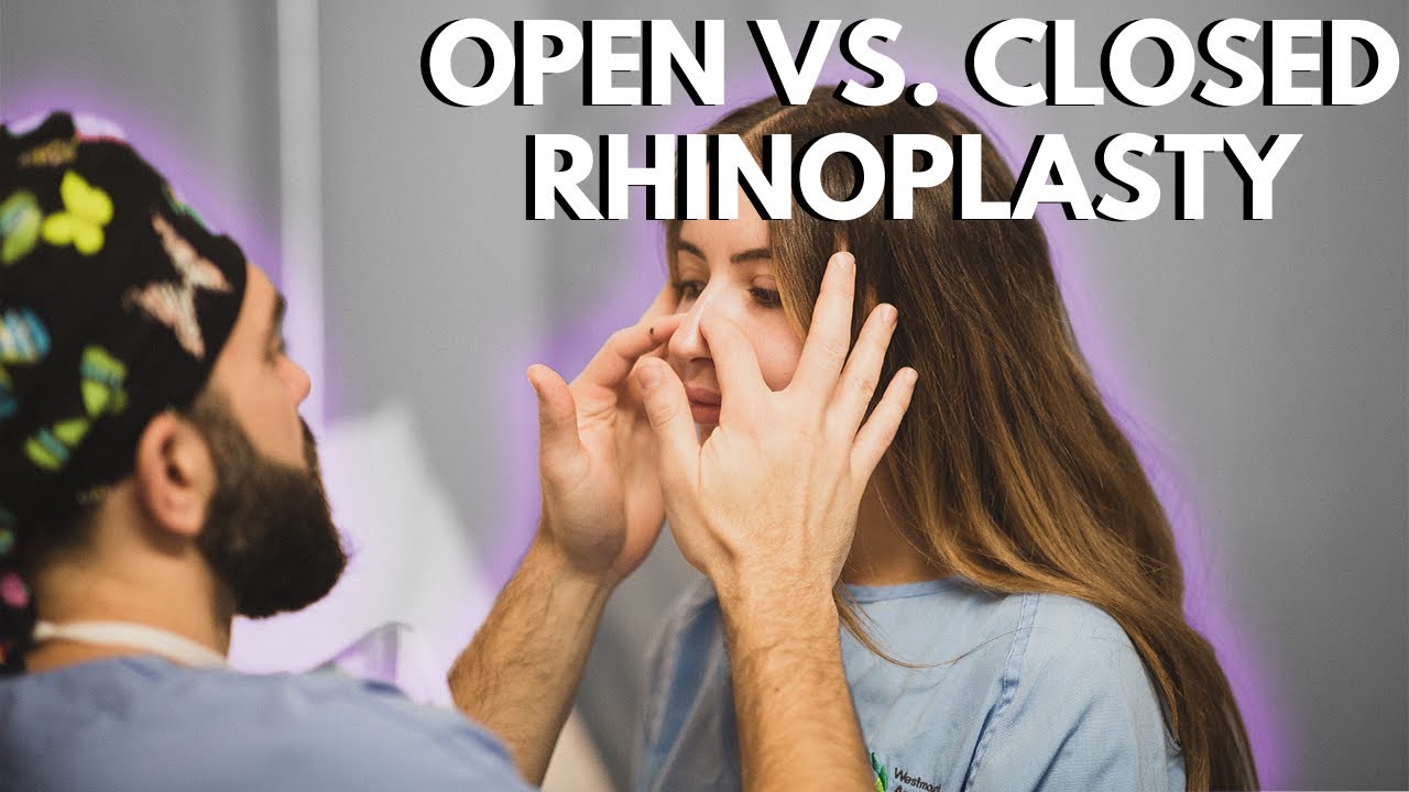 Rhinoplasty Procedure Overview - YouTube