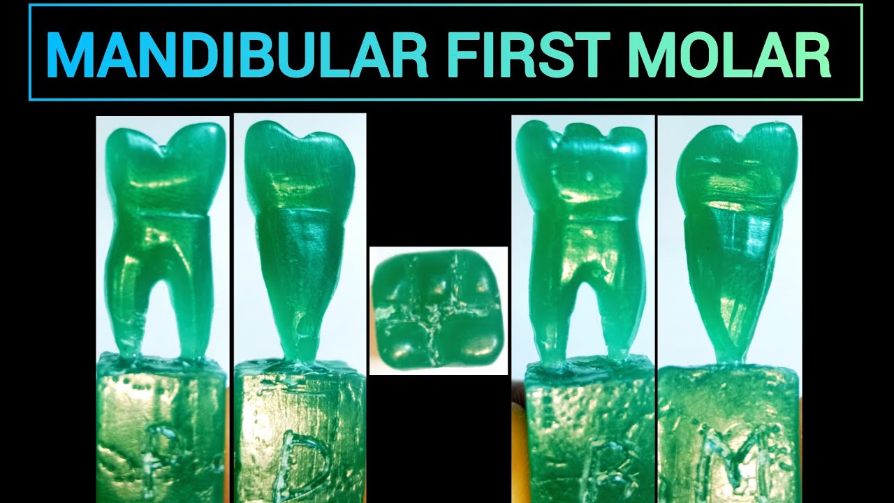 Carving Of Mandibular First Molar || STEP BY STEP || Carving Tutorial # ...