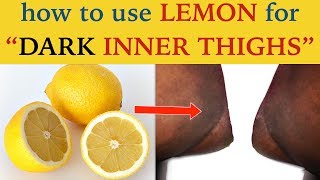 Dark Inner Thighs Lemon