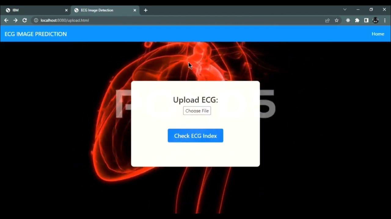 ECG classification using Deep learning - YouTube