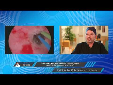 7 İdrar yolu darlığında lazerle yapılan kapalı ameliyatlar başarıyı artırır mı