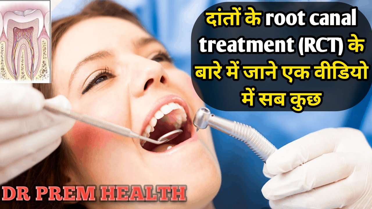 दांतो का #root_canal_treatment (RCT) के सभी प्रकार , all type of dental ...