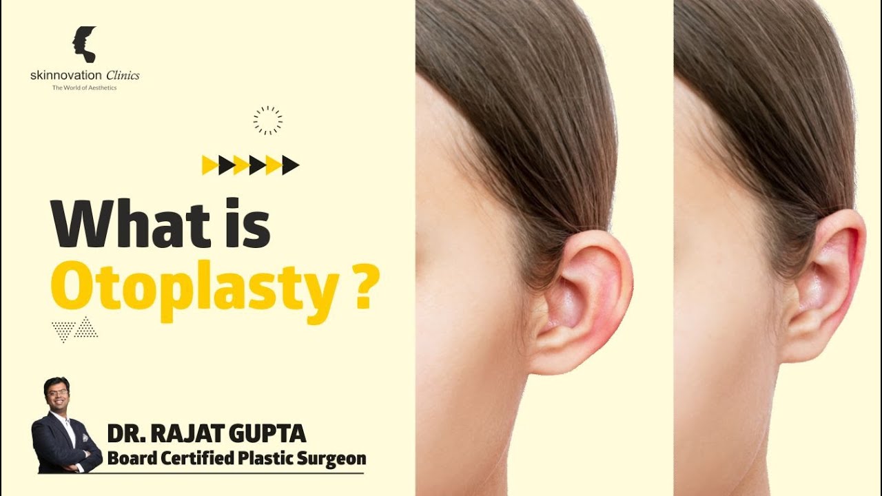 What is Otoplasty ? Prominent ear correction surgery | Dr Rajat Gupta ...