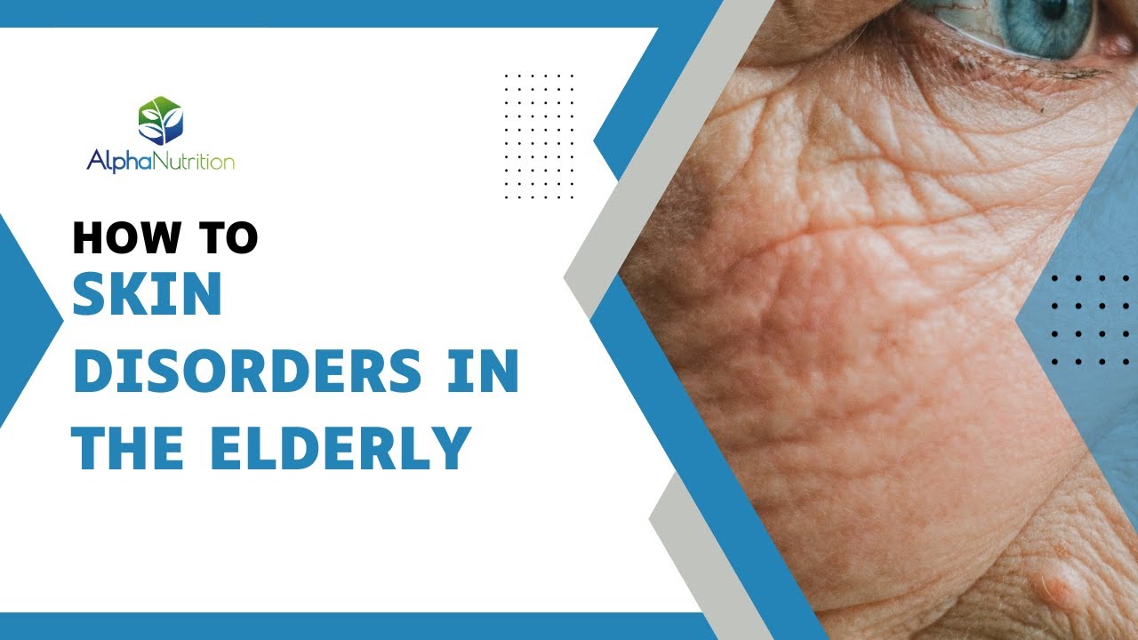 Age with Grace: Understanding Skin Disorders in the Elderly - YouTube