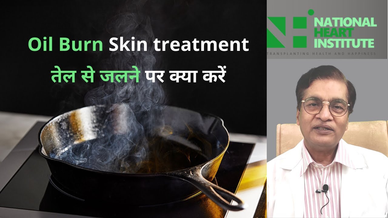 तेल से जलने पर क्या करें Oil Burn Skin Treatment Home Remedy | Dr ...