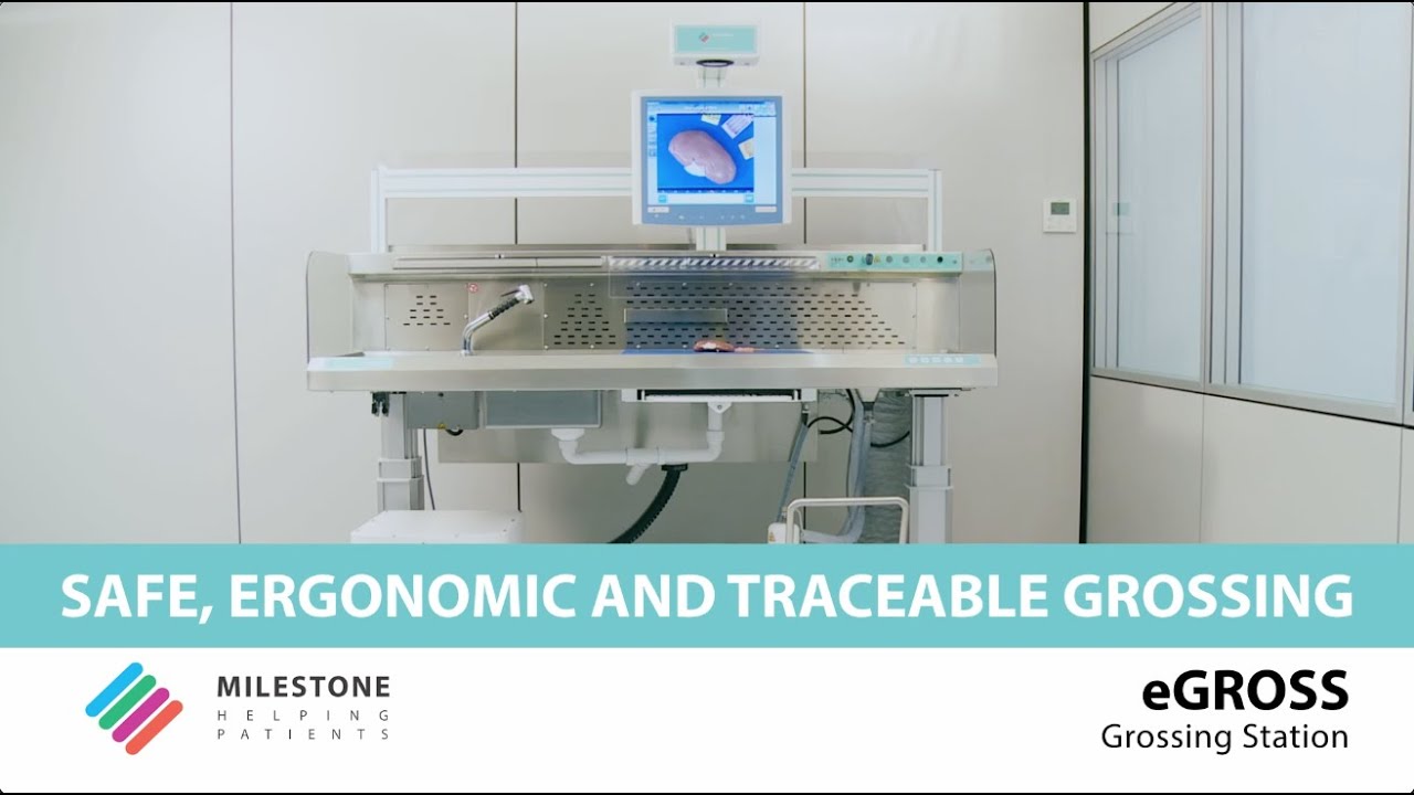 eGROSS: Safe, Ergonomic and Traceable Grossing - YouTube