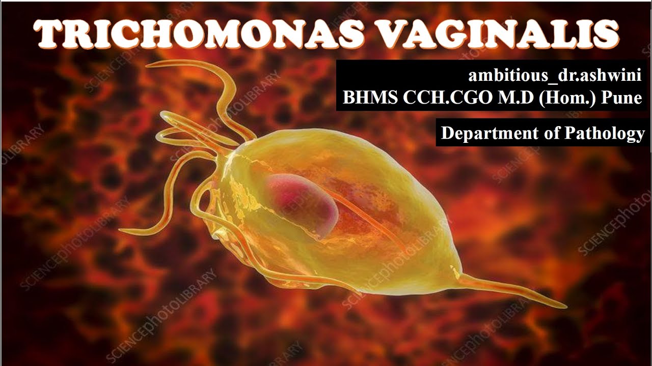 Trichomonas vaginalis ppt #trichomonasvaginalis #protozoa #pathology ...