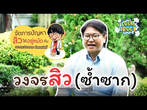 อยากหลุดจาก “วงจรสิว” ซ้ำซาก ต้องทำยังไง - จัดการปัญหาสิวให้อยู่หมัด EP.7