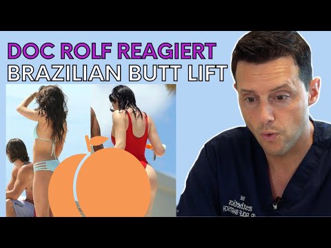 Po Vergrößerung mit BRAZILIAN BUTT LIFT (BBL) – wer folgt dem Trend?! doc.rolf
