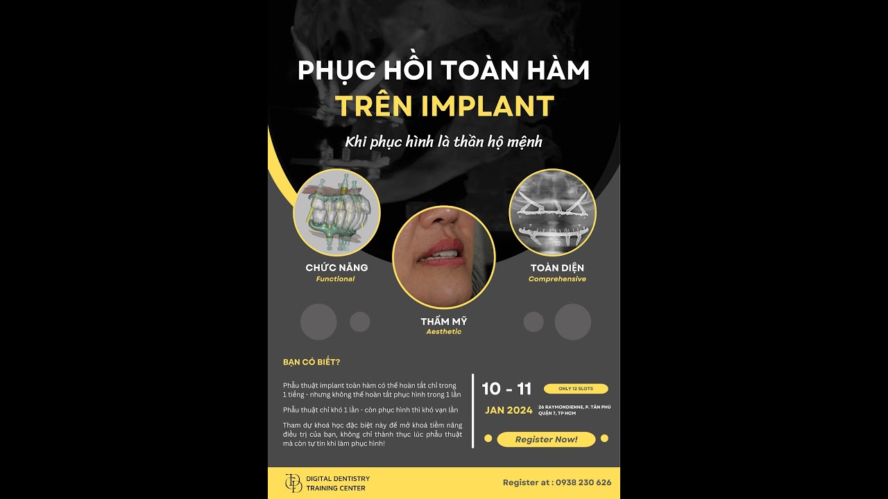 Pterygoid & transnasal implant planning with Realguide - YouTube