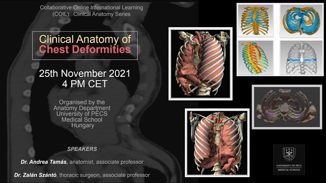 COIL Clinical Anatomy Series - Clinical Anatomy of Chest Deformities ...