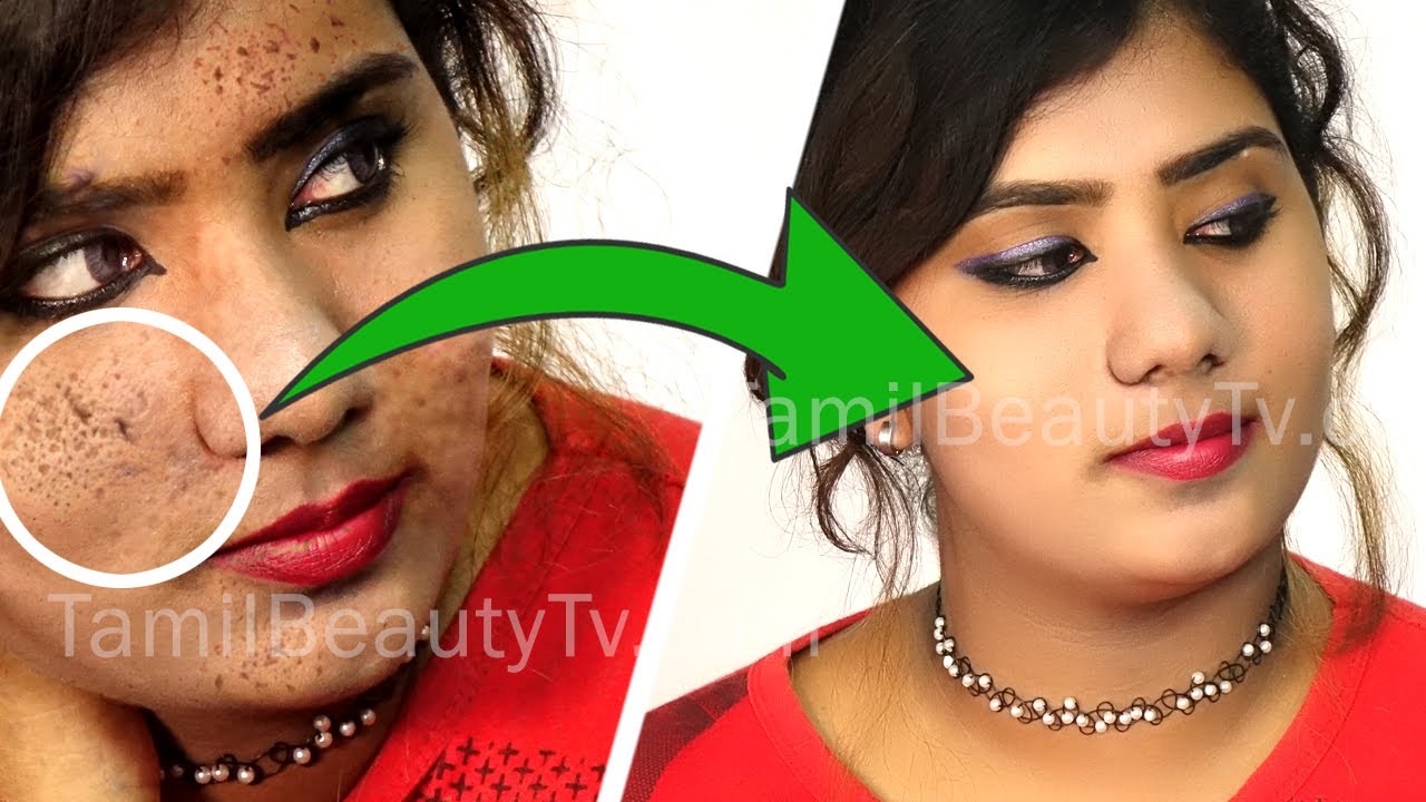 How To Remove Pimple Marks Home Remedies For Black Spots On Face how-to-remove-pimple-marks-home-remedies-for-black-spots-on-face