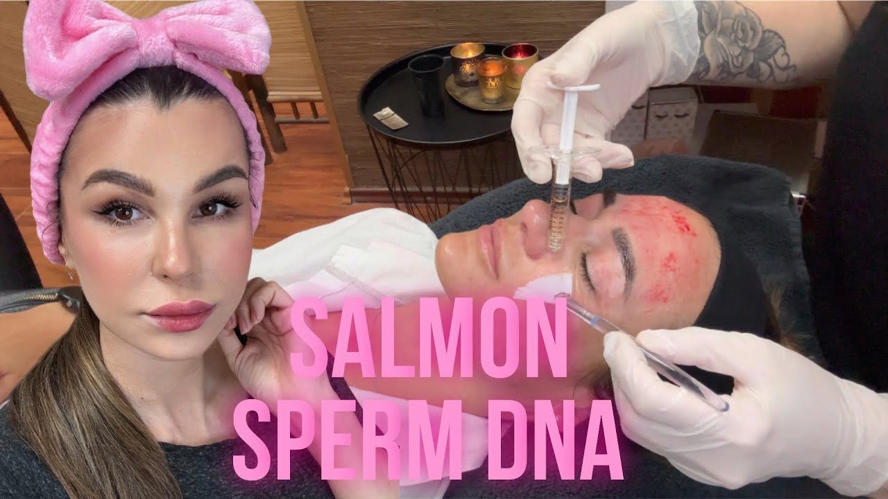 Microneedling with DNA from SALMON SPERM | polynucleotide | PDRN - YouTube