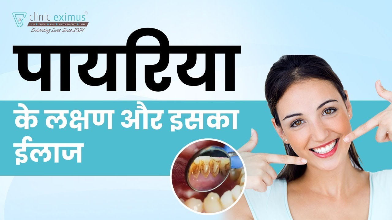 Pyorrhea Ka ilaj | Gum Problems In Teeth | Pyorrhea Prevention ...