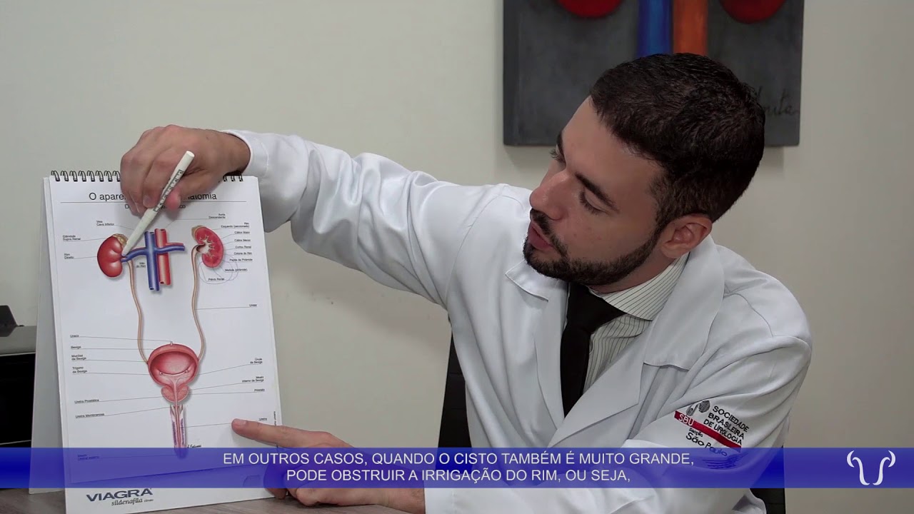 Dr João Juveniz Cisto Simples De Rim Youtube
