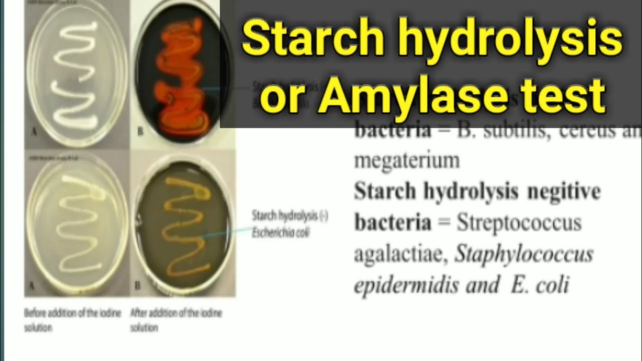 Starch hydrolysis Test: Amylase test: biochemical test lecture 13 - YouTube