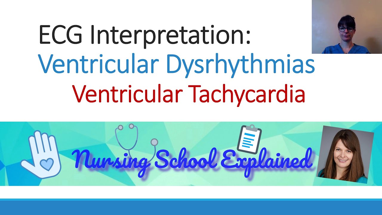 Ventricular Tachycardia (VTach) - YouTube