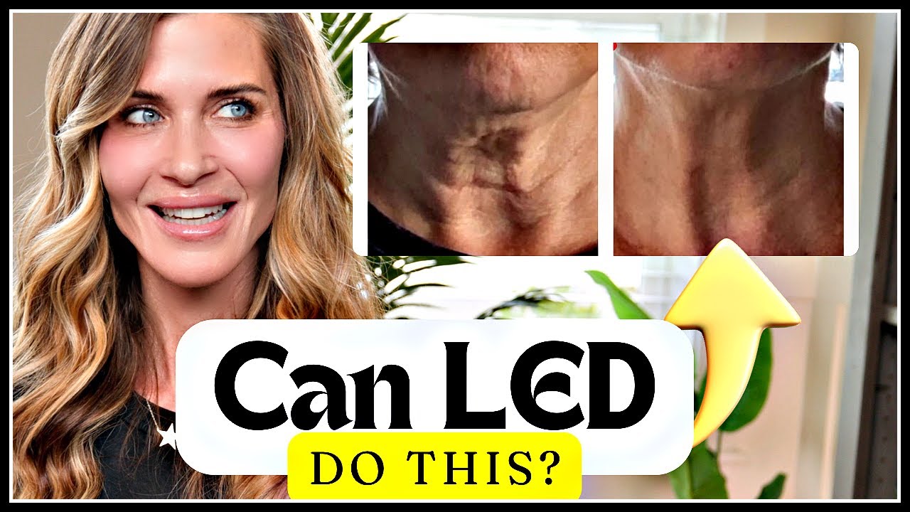 EXPERT Guide to LED: Melasma, Eye Health, Fat Loss...What LED can and ...