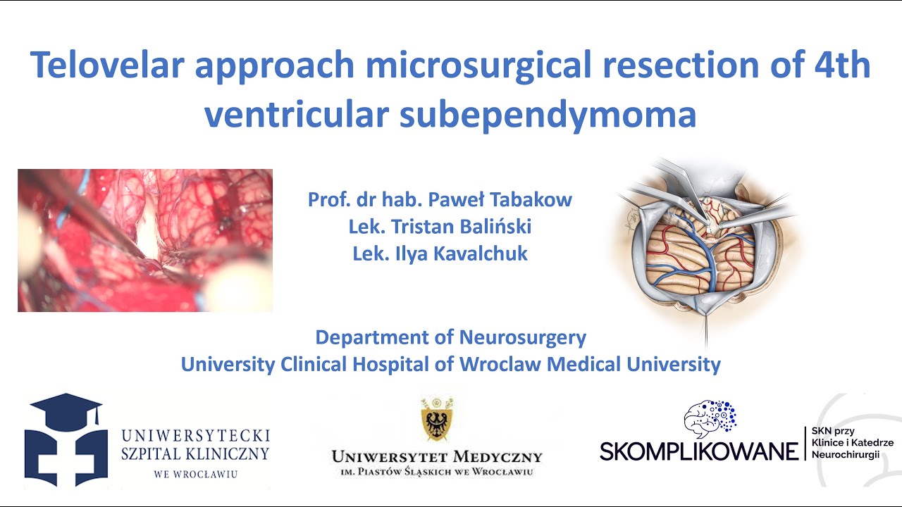 Telovelar approach microsurgical resection of 4th ventricle ...