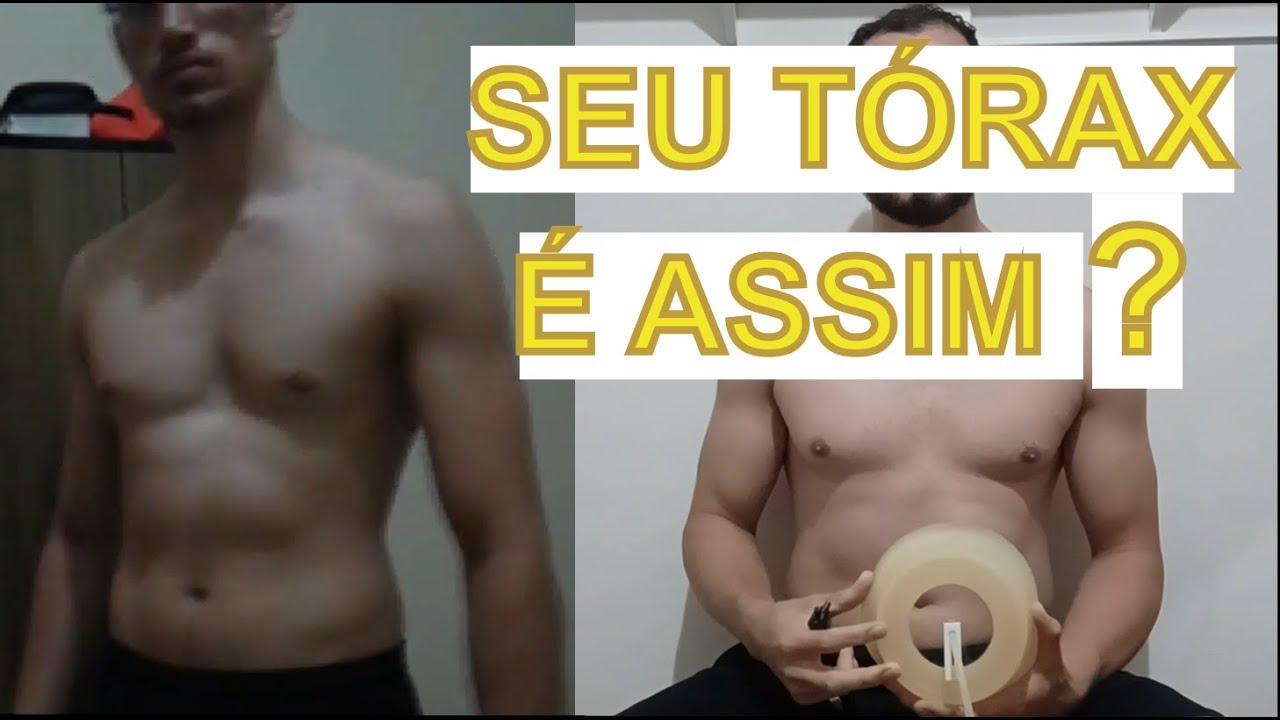 SEU TÓRAX É AFUNDADO? SAIBA O QUE É ISSO E COMO CORRIGIR - YouTube