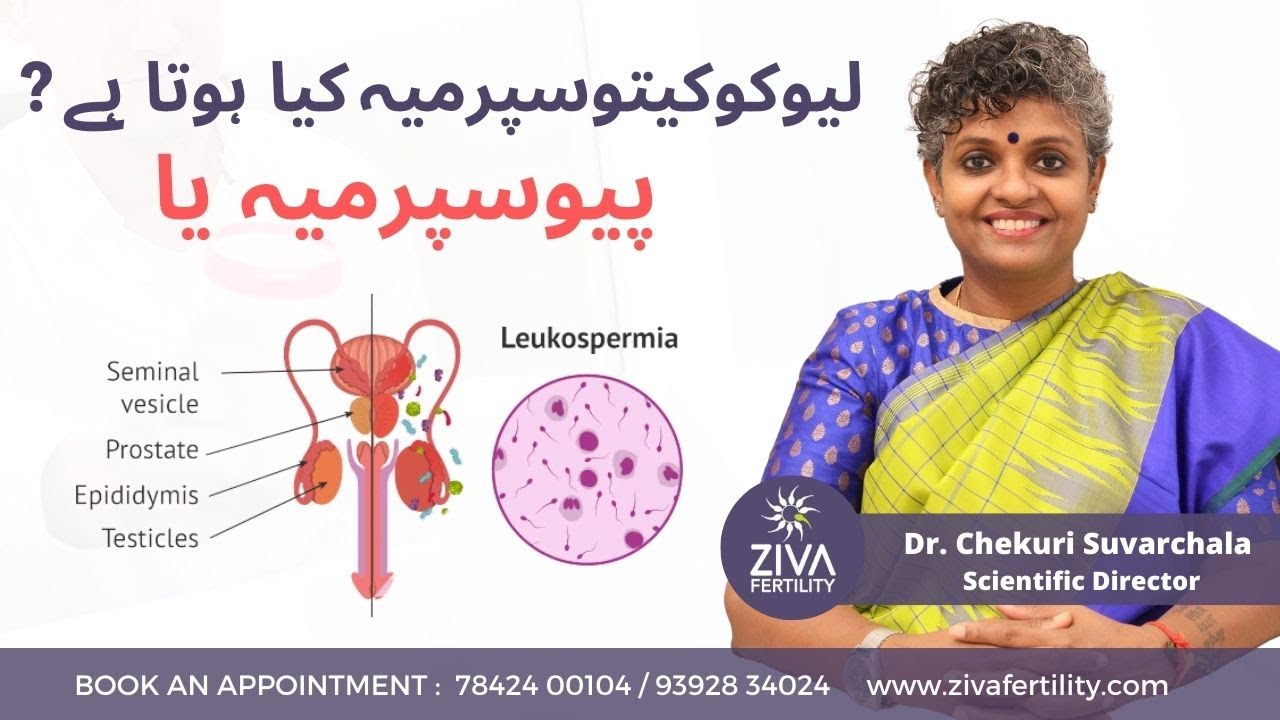 Pyospermia or Leukocytospermia || پیوسپرمیہ یا لیوکوکیتوسپرمیہ کیا ہوتا ...