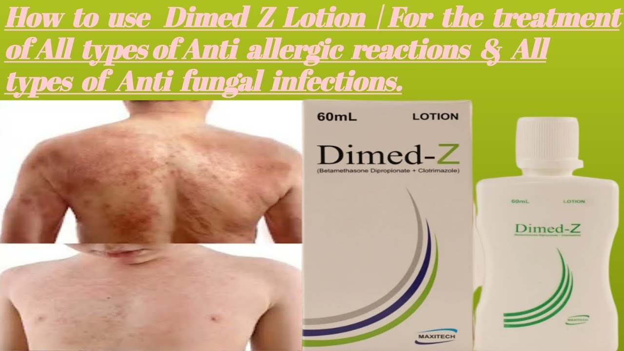 How to use Dimed Z Lotion|For the treatment of All types of Anti ...