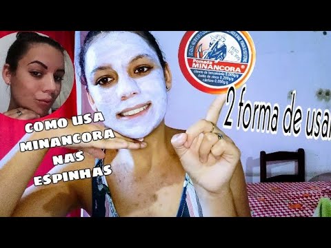 COMO USAR MINANCORA nas espinhas + 2 FORMA DE PASSAR - YouTube