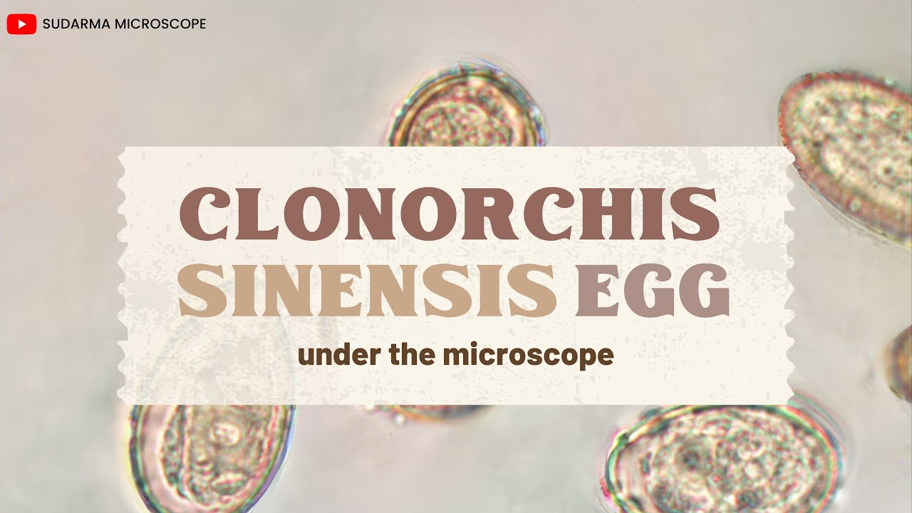 Clonorchis sinensis egg under the microscope - YouTube