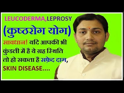 LAPROSY#LEUCODERMA#(KUSHTH ROG YOG)#SAFED DAAG# IN JANM KUNDALI BY ...
