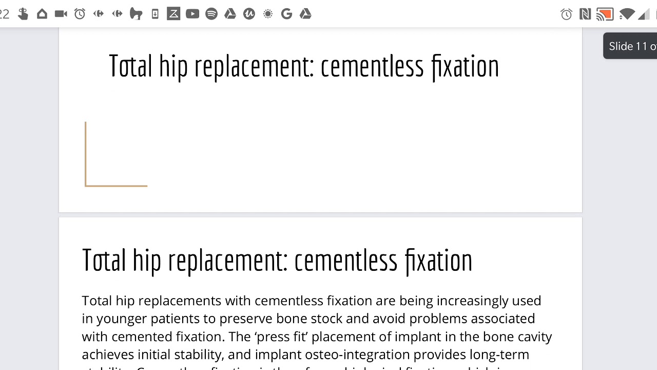 total hip replacement cementless fixation - YouTube
