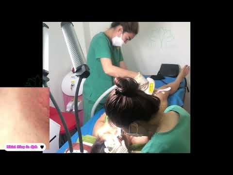 Hậu Trường Làm Hồng Vùng Kín ( Cô bé )/ Các phương pháp làm Hồng Bikini Bằng Laser Peel / Mộc Ý Liên