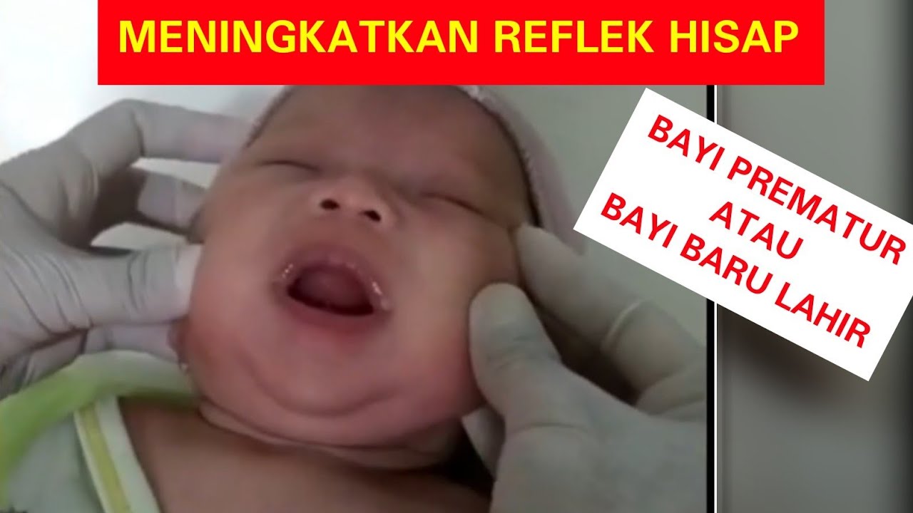 Meningkatkan Reflek Hisap Bayi Baru lahir atau Prematur. Pijat oromotor ...