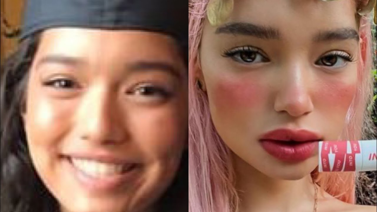 Pasabist (sab zada) before and after side by side photos in person vs ...