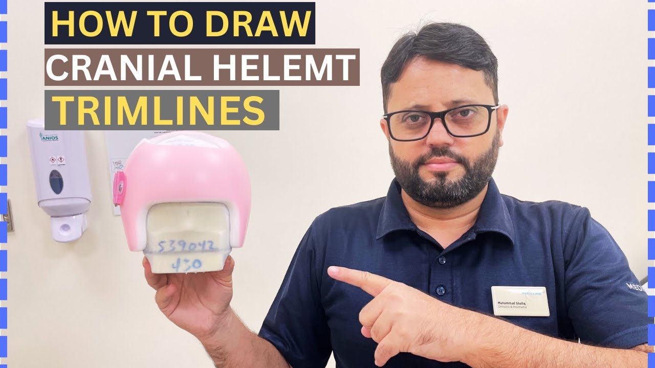Trim lines Of Cranial Remolding Orthosis | Cranial Helmet Trim line ...