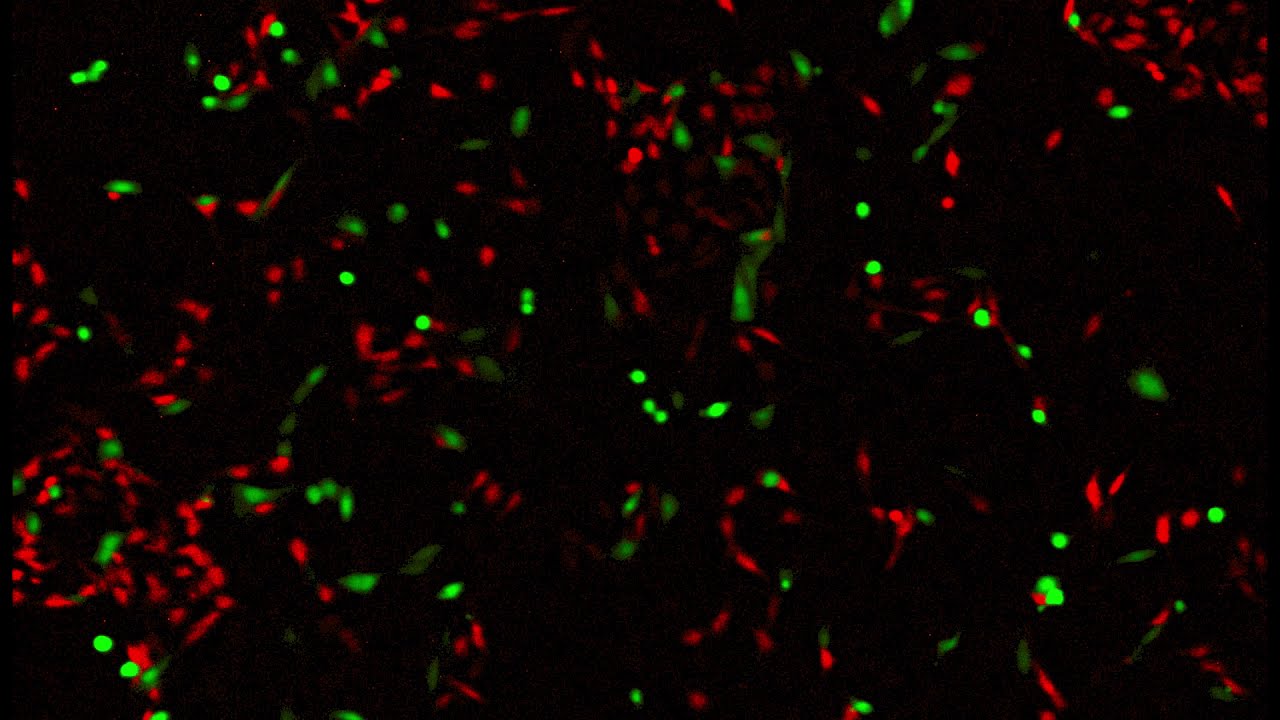 Time lapse of co-culture of C6 cells together with 3T3 cells ...
