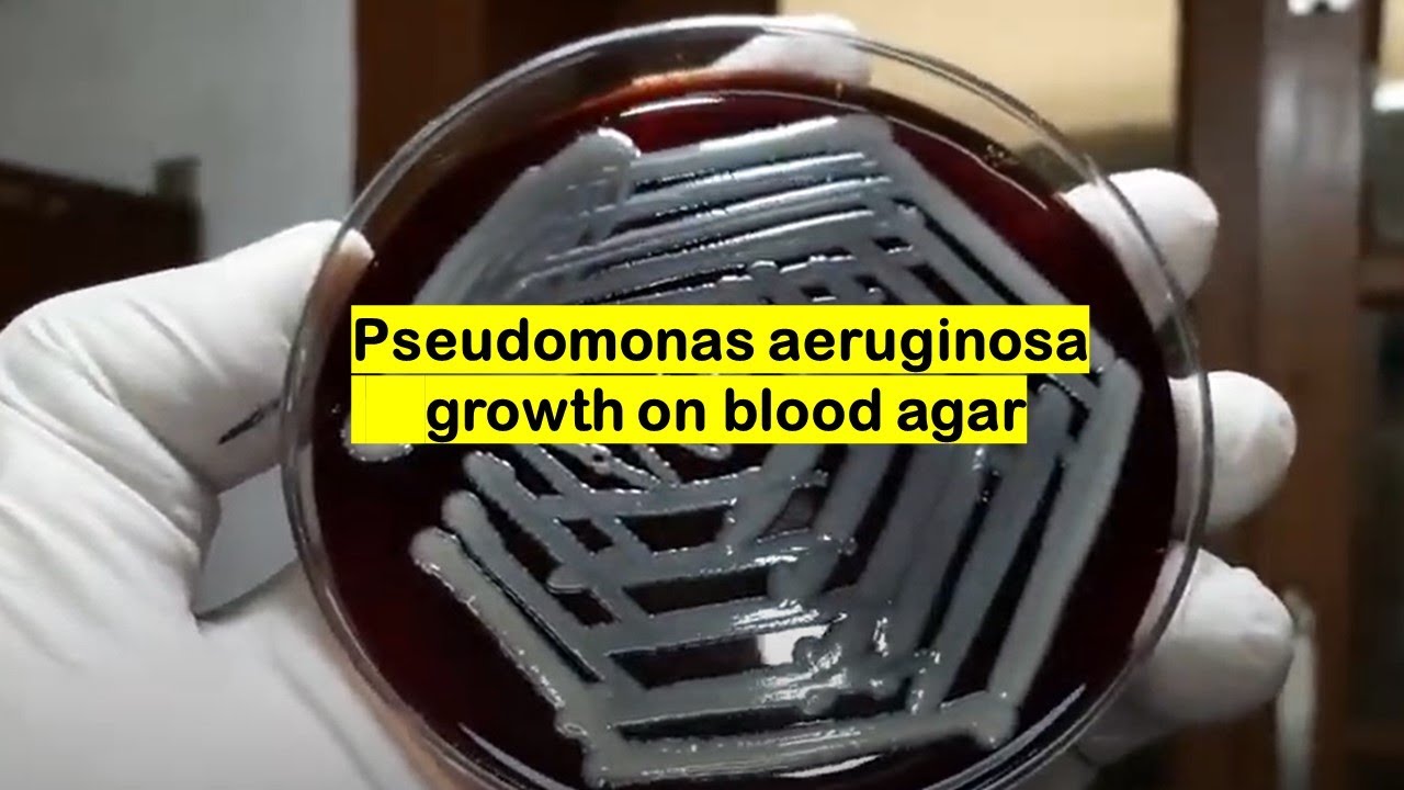 Blood agar having Growth of Pseudomonas aeruginosa - YouTube