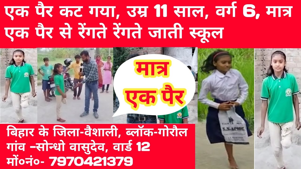 एक पैर कट गया है मात्र एक पैर से रेंगते रेंगते स्कूल जाती है यह बच्ची ...