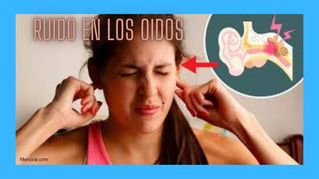 TINNITUS o ACÚFENOS Zumbidos o Ruidos En Los Oidos - YouTube