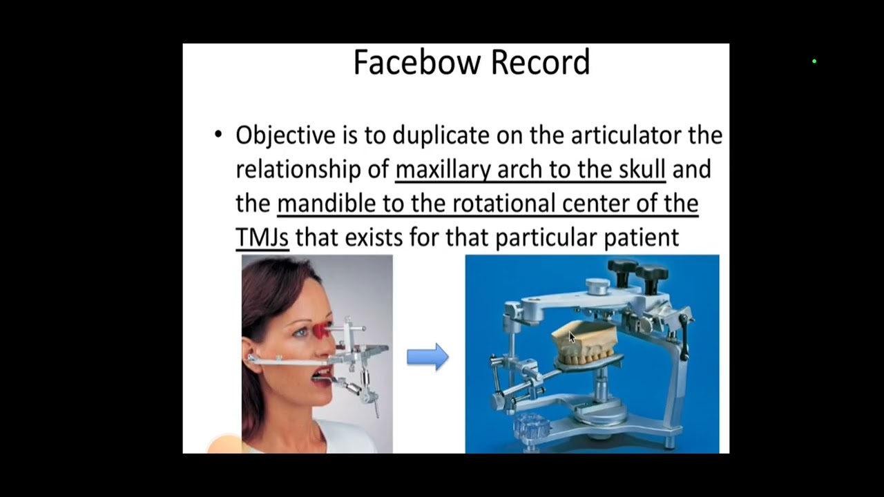 Facebow record - YouTube